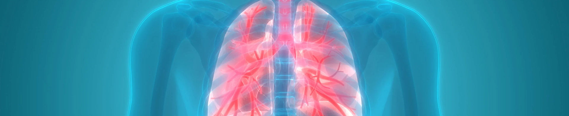 TB(Tuberculosis) Skin and Blood test in Toronto - SanoMed Medical Clinic